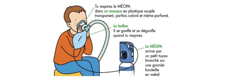 Le MEOPA | Odontopole | Clinique dentaire à Arras